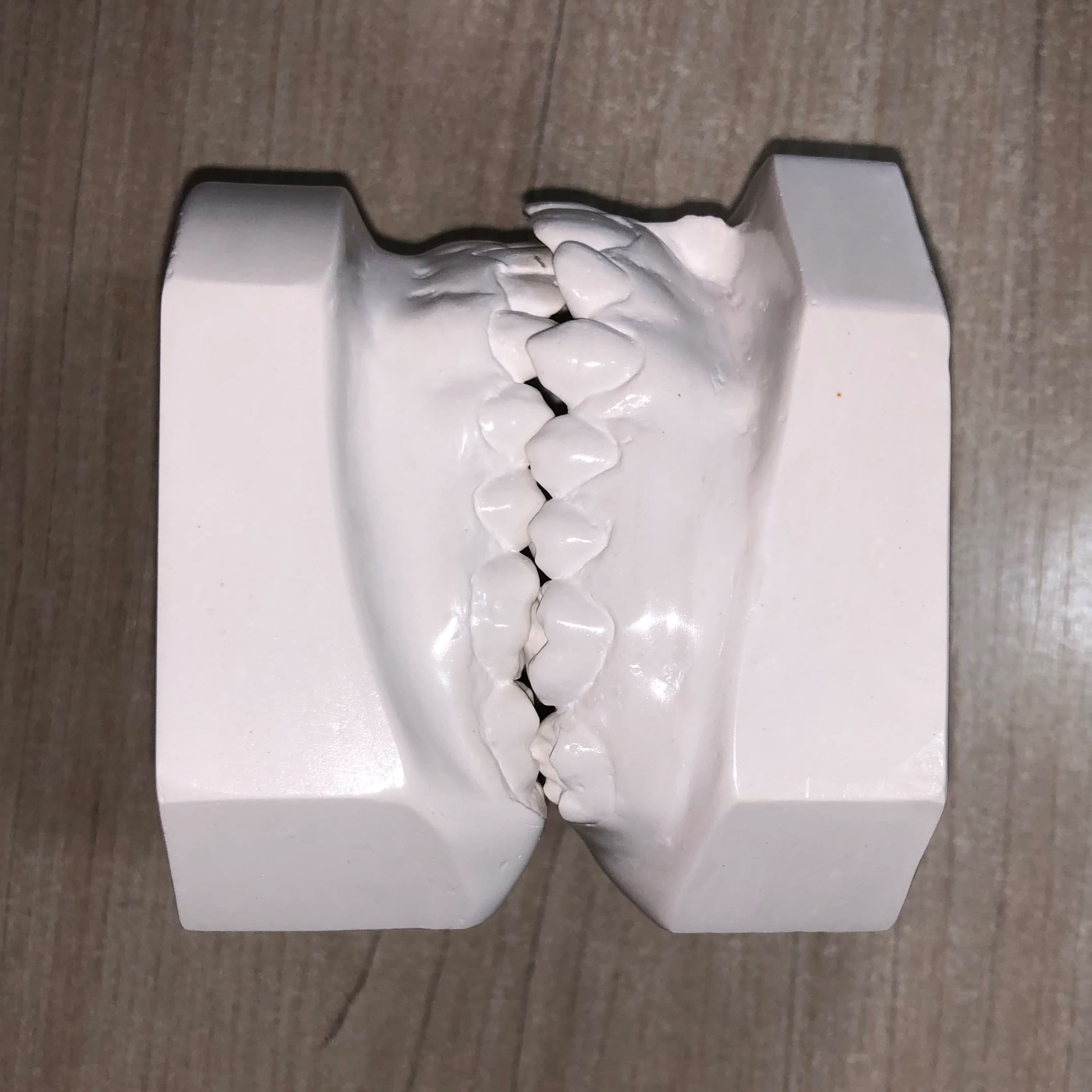 Modelos de estudo das arcadas dentárias - FK Radiologia